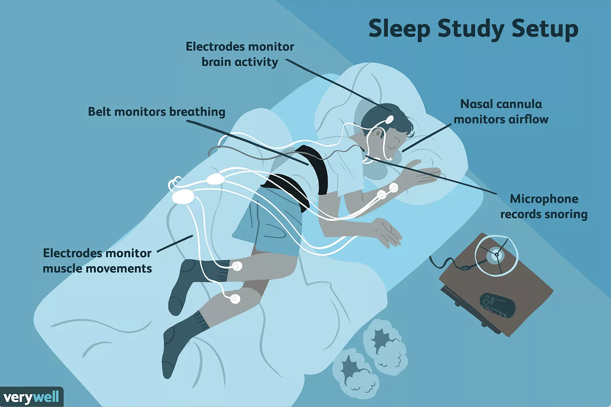 Using Deep Learning For Sleep Stage Classification